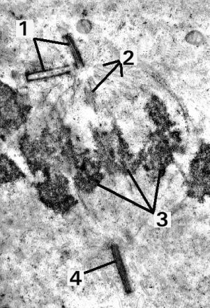Ultrastructure of the cell